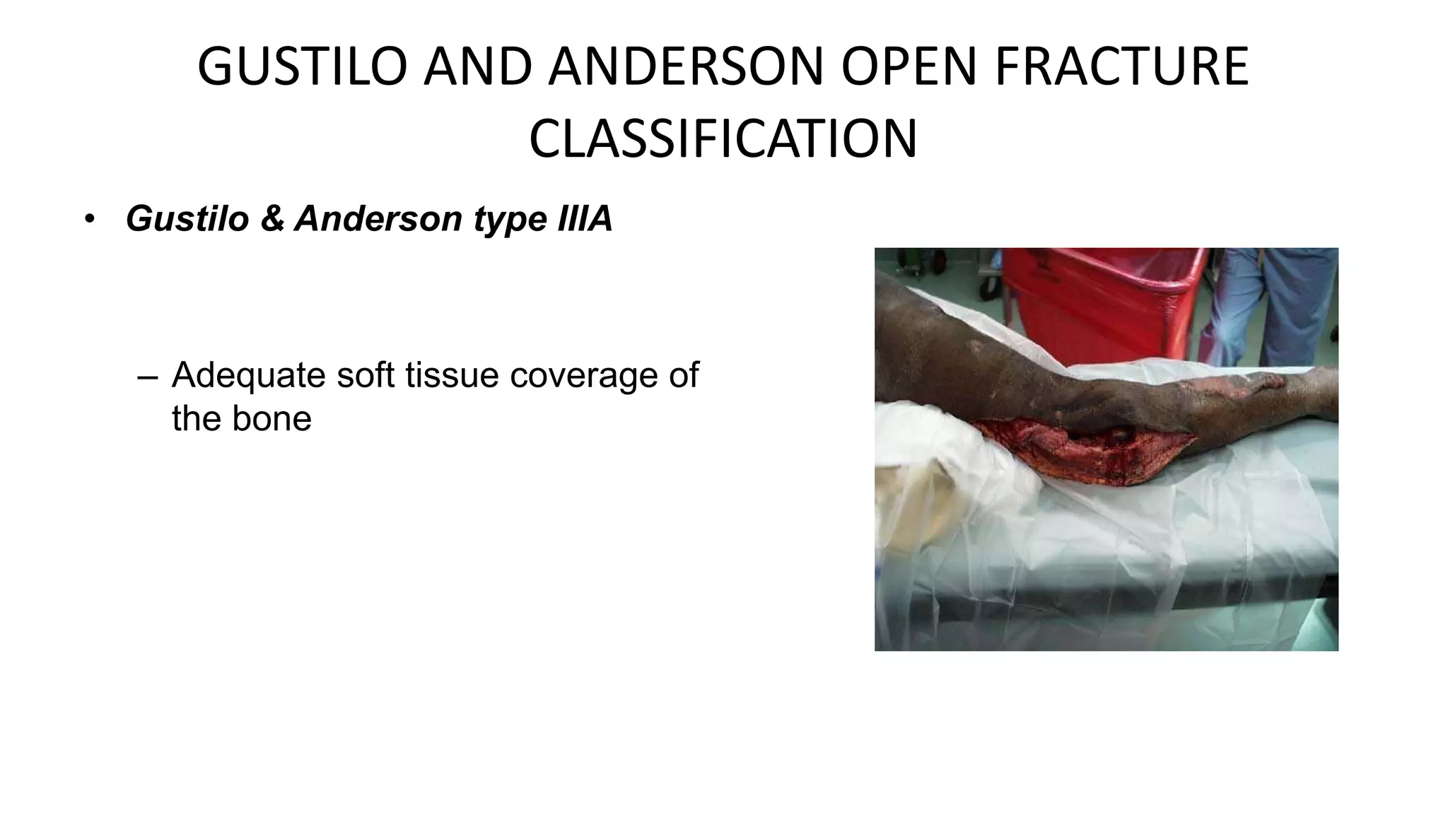 Principles of management of open fracture | PPTX