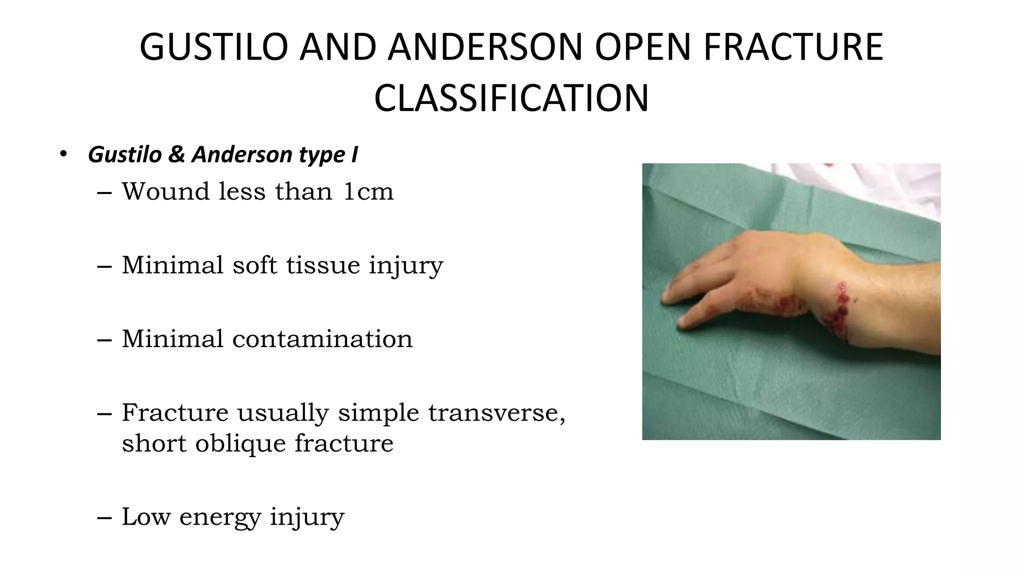 Principles of management of open fracture | PPTX | Death, Injury, or ...