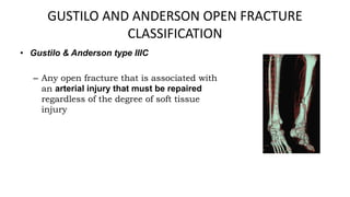 Principles of management of open fracture | PPTX | Death, Injury, or ...