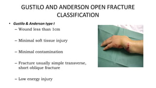 Principles of management of open fracture | PPTX | Death, Injury, or ...