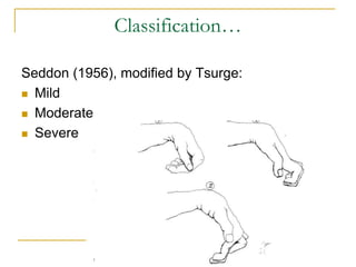 Principles of management of volkmann’s contracture | PPTX