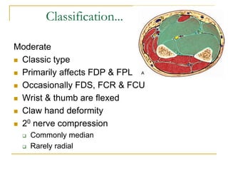 Principles of management of volkmann’s contracture | PPTX