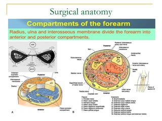 Principles of management of volkmann’s contracture | PPTX