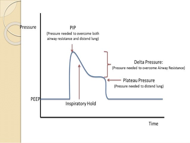 Principles of mechanical ventilation part 1