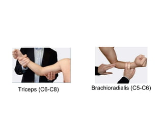 Peripheral Nerve Injury: Radial Nerve Palsy | PPTX