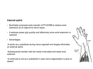 Peripheral Nerve Injury: Radial Nerve Palsy | PPTX