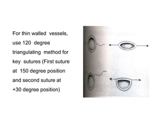 Principles of Microsurgery | PPTX