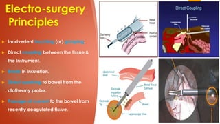 Principles of Minimal Invasive Surgery or Laparoscopic Surgery | PDF ...