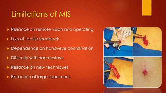 Principles of MIS | PPTX | Digestive Disorders | Diseases and Conditions