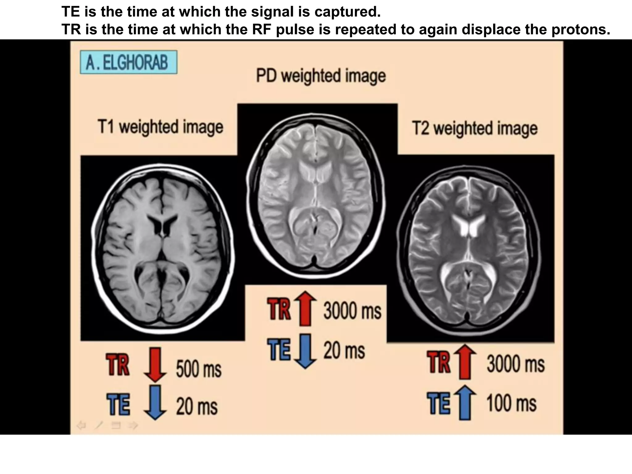 Principles of MRI | PPTX