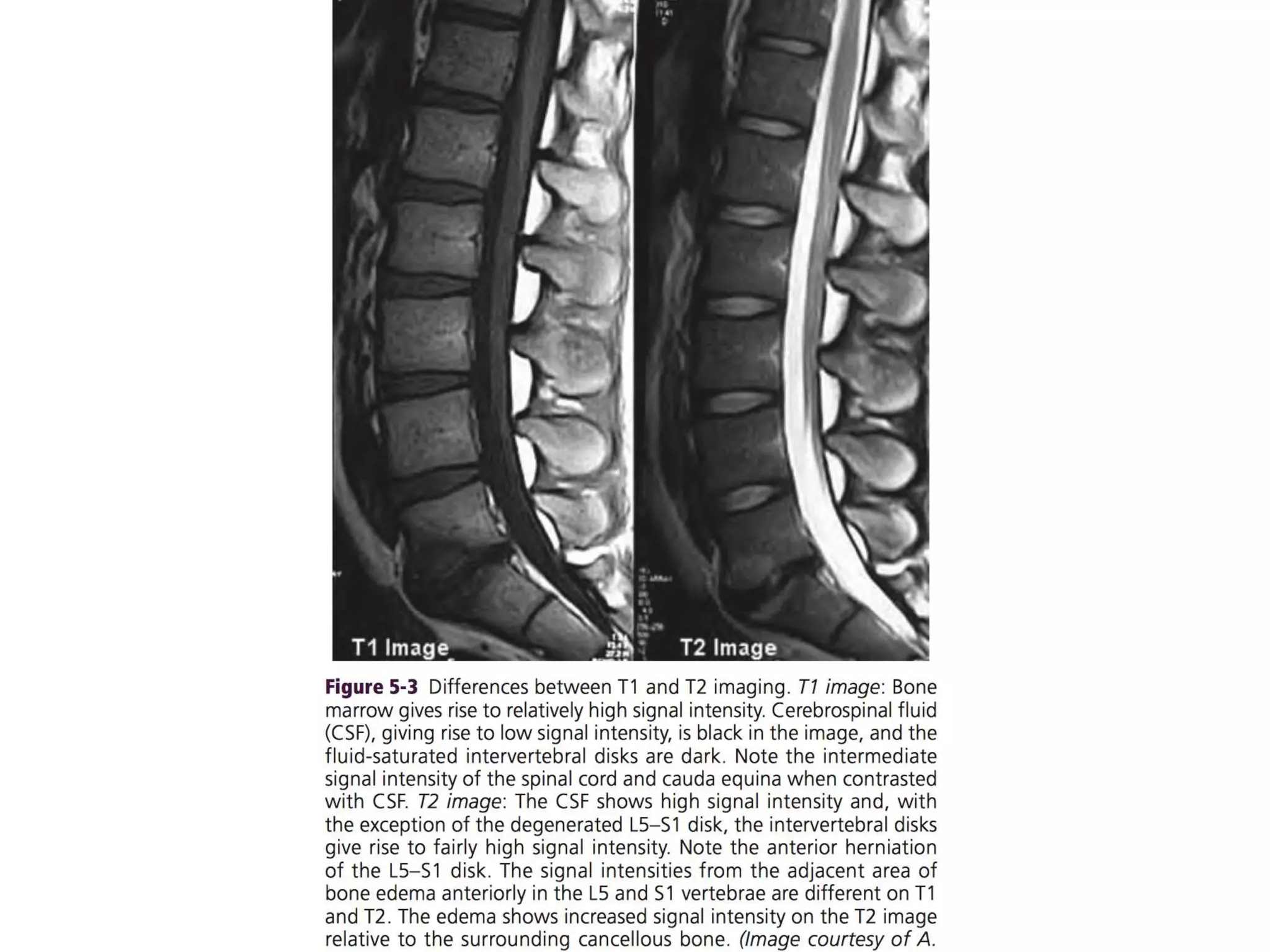 Principles of MRI | PPTX