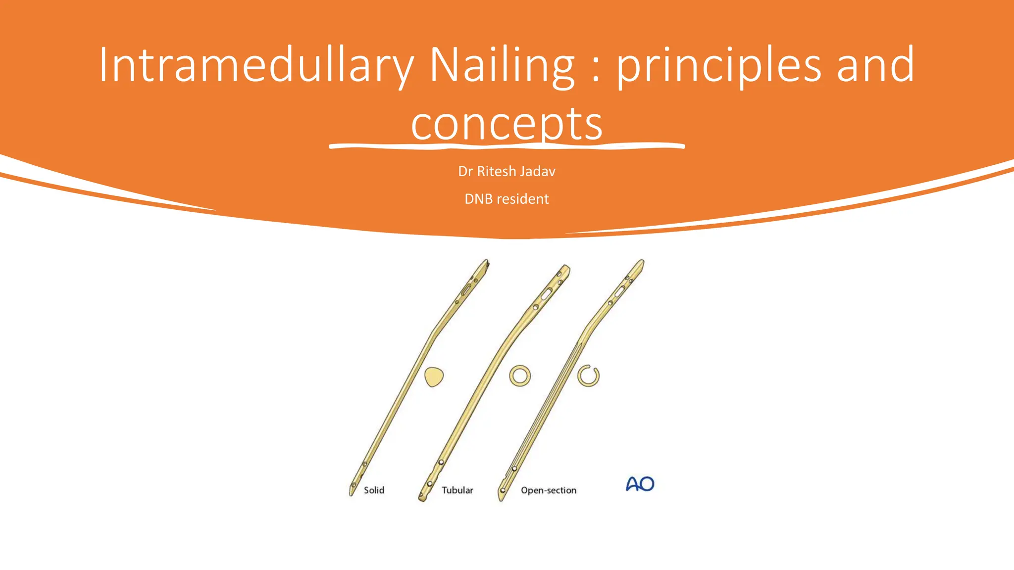 Principles of nailing by Dr Ritesh Jadav | PPTX