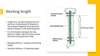 Principles of nailing by Dr Ritesh Jadav | PPTX