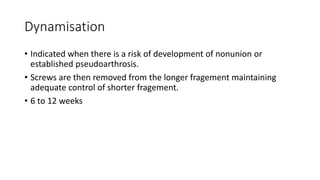Principles of nailing by Dr Ritesh Jadav | PPTX