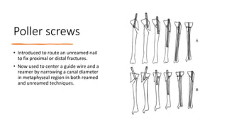 Principles of nailing by Dr Ritesh Jadav | PPTX