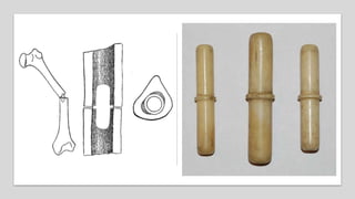 Principles of nailing by Dr Ritesh Jadav | PPTX