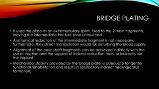 principles of nailing and plating-1.pptx
