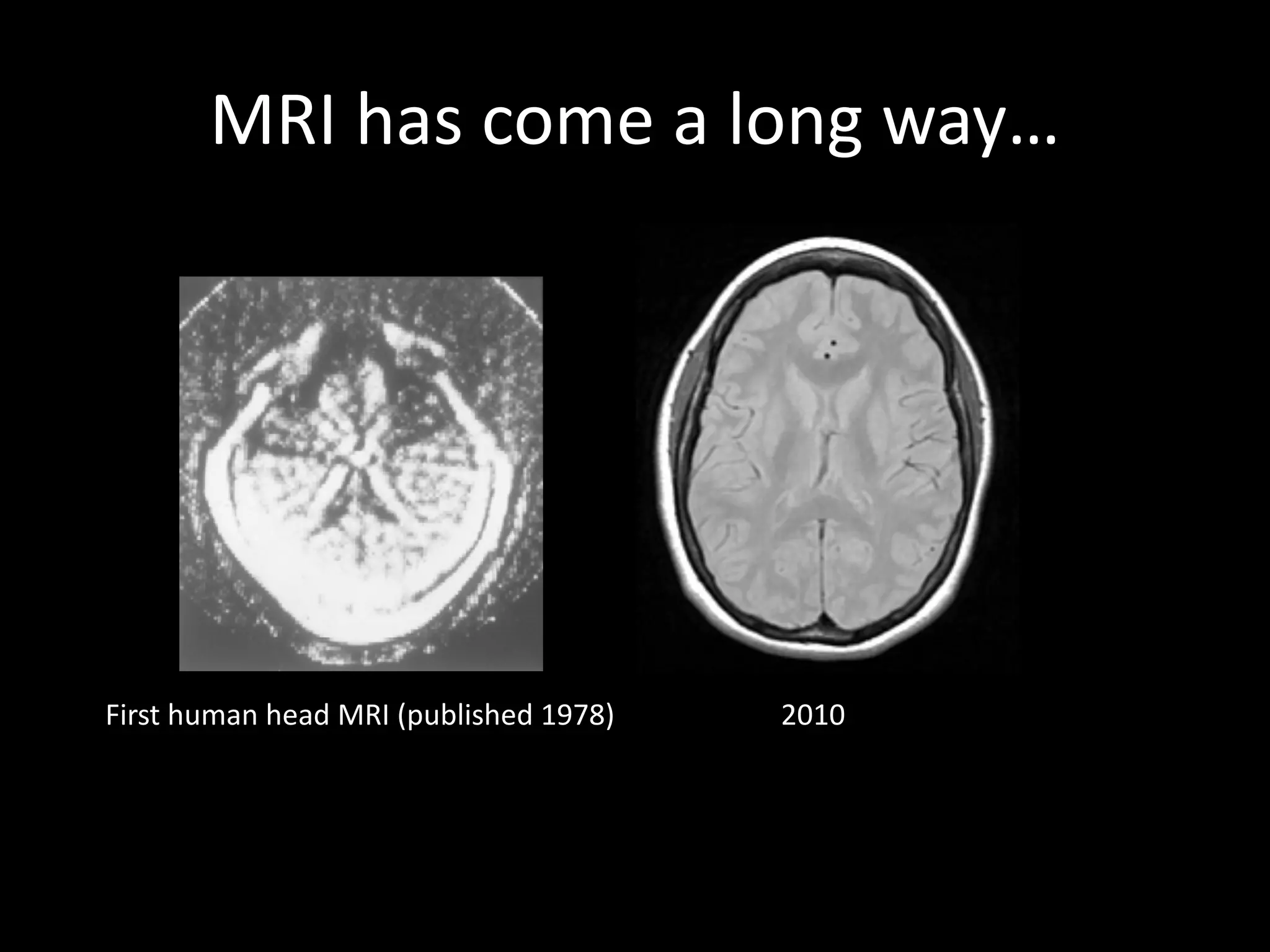 Principles of (N)MR Imaging | PDF