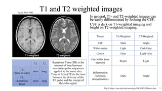 A presentation on Principles of NMR imaging system | PPTX
