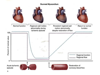 Principles of nuclear cardiology | PPSX