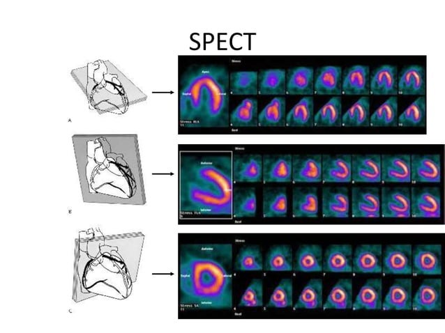 Principles of nuclear cardiology