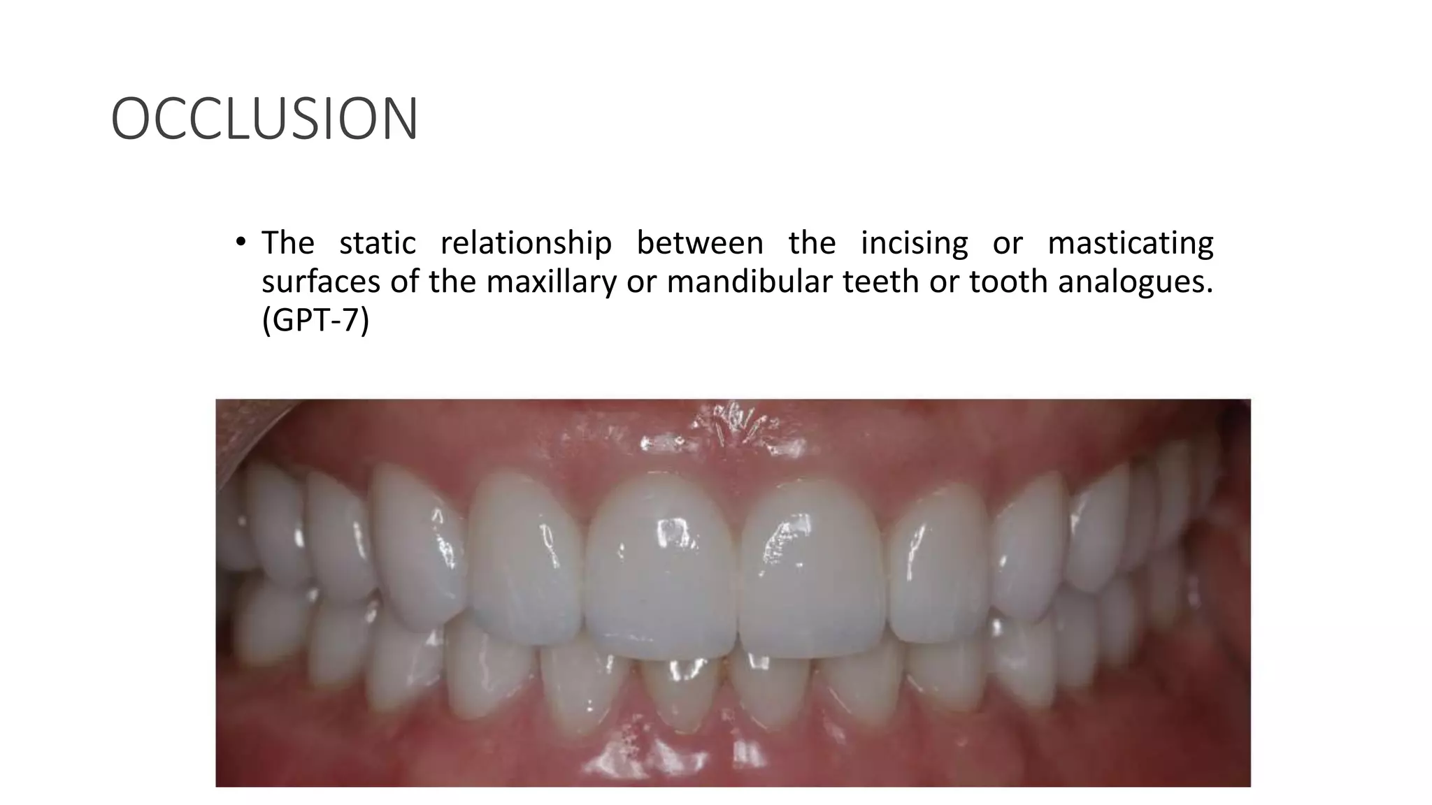 Principles of occlusion.pptx