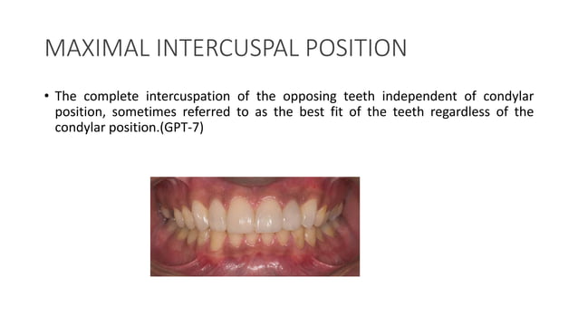 Principles of occlusion.pptx | Dental Health | Diseases and Conditions