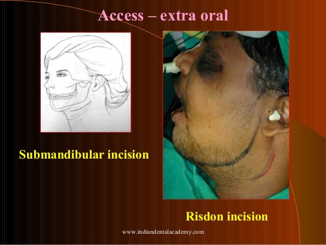 Principles of oral surgery.. (nx power lite) /certified fixed orthodo…