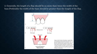 Principles of oral surgery | PPTX