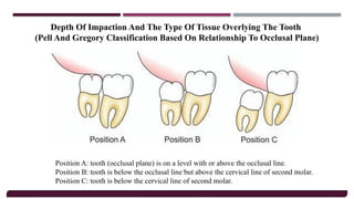 Principles Of Oral Surgery, Armamentarium &.pptx