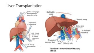 PRINCIPLES OF ORGAN TRANSPLANTATION 2003.ppt