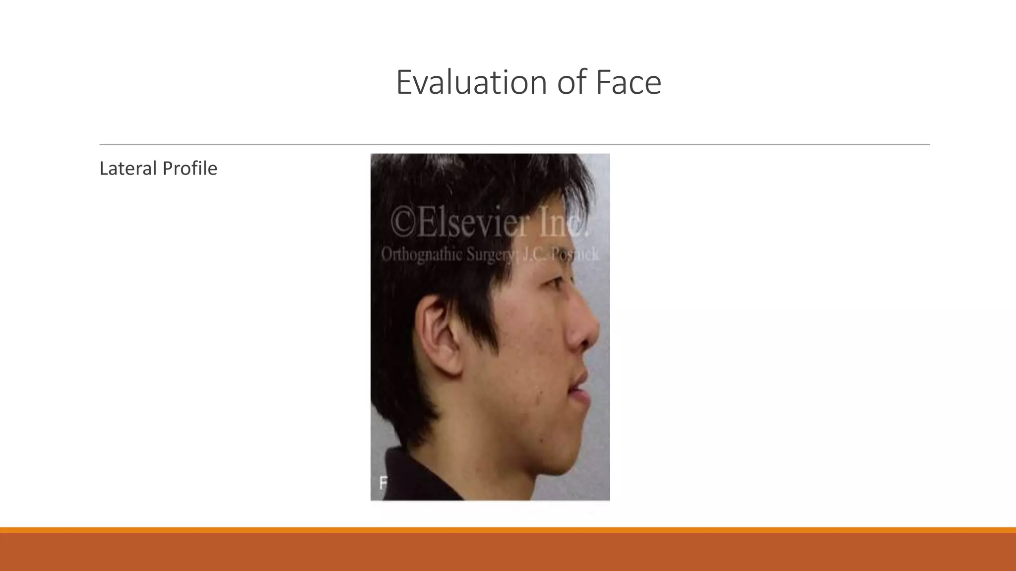 Principles of orthognathic management of dentofacial deformities | PPTX