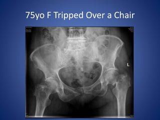 Principles of orthopaedic care | PPTX