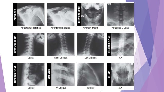 Principles of Pathological Investigation and Imaging in Skeletal ...