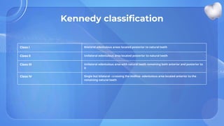 principles of PD design.pptx