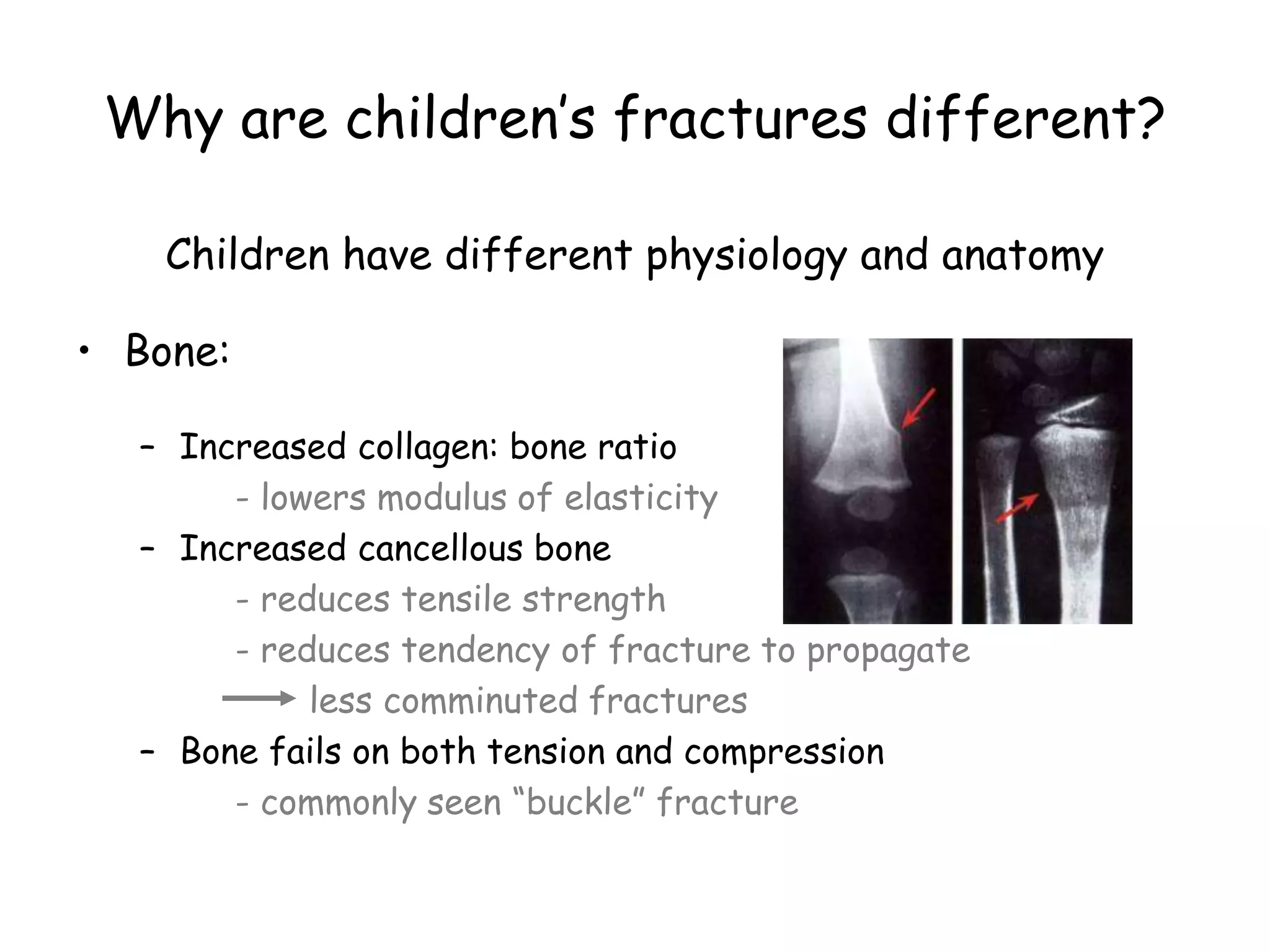 Principles_of_Pediatric_Fractures.ppt