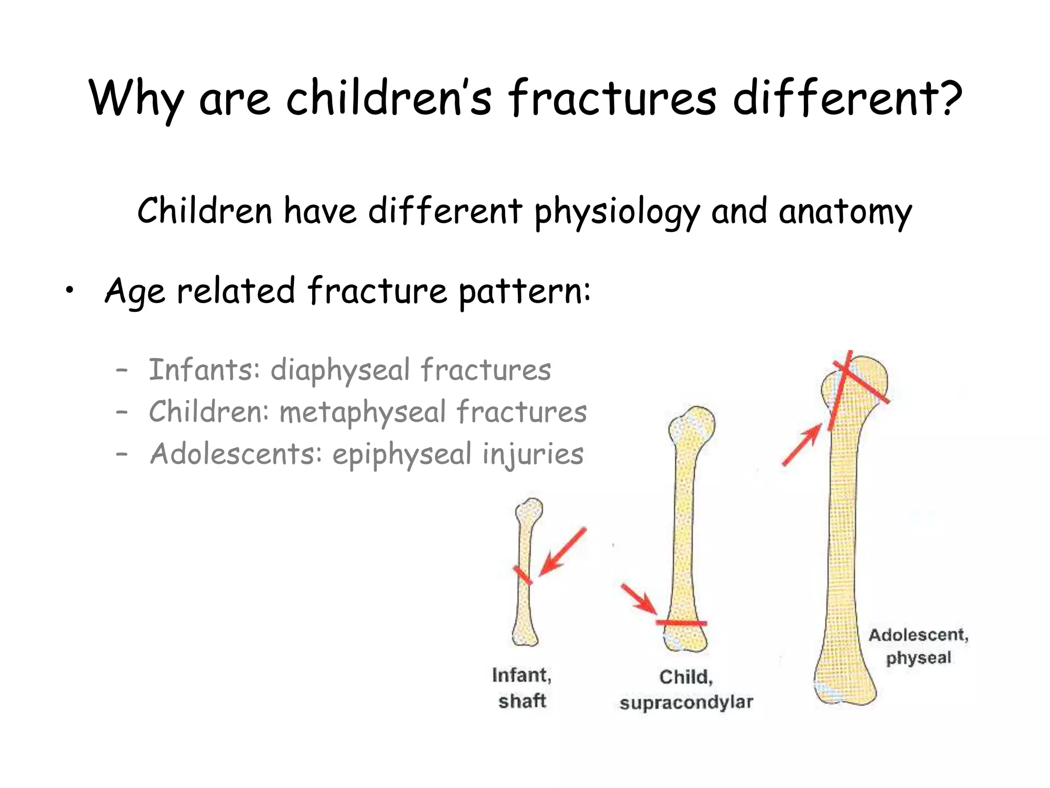 Principles_of_Pediatric_Fractures.ppt