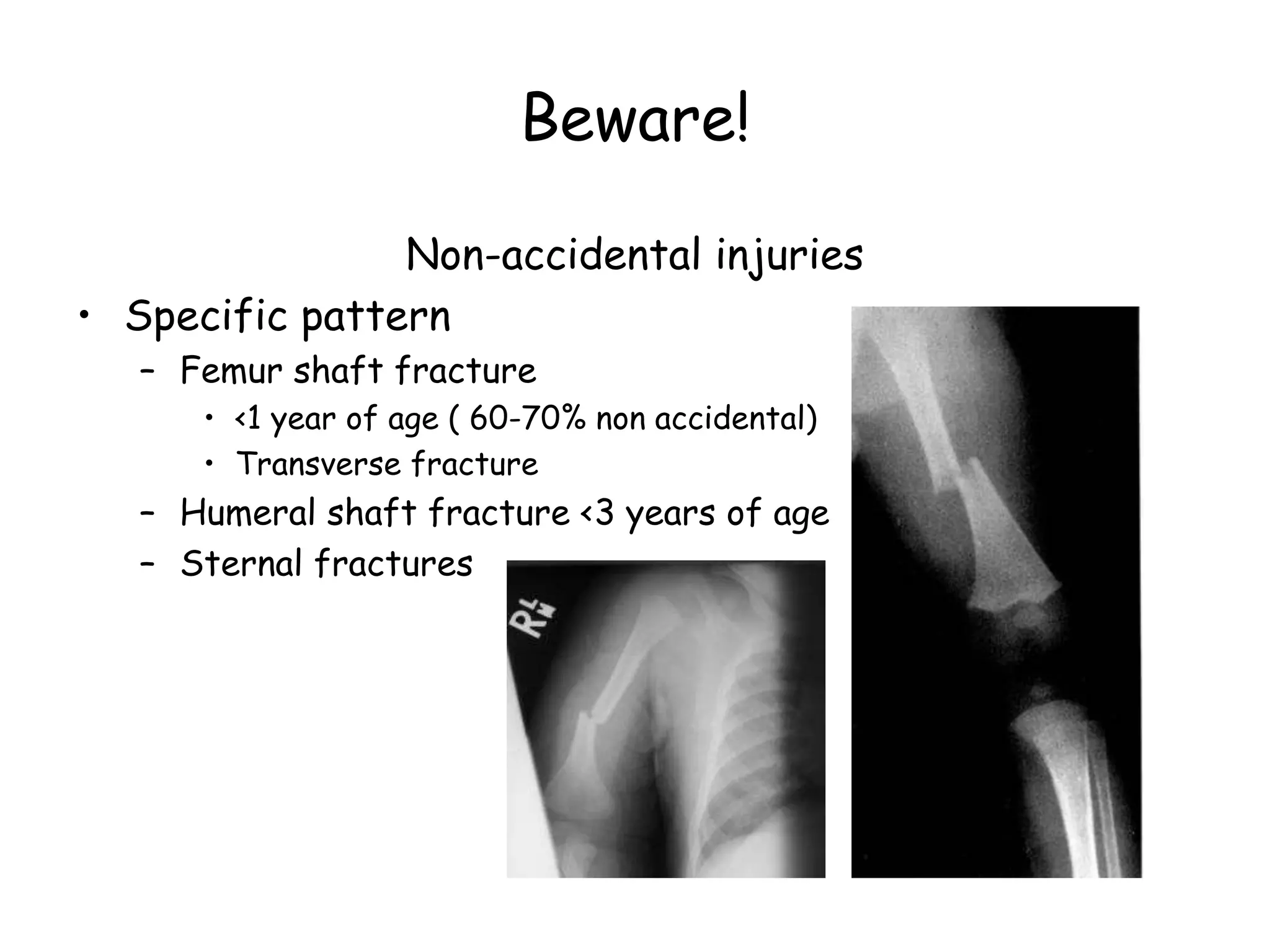 Principles_of_Pediatric_Fractures.ppt