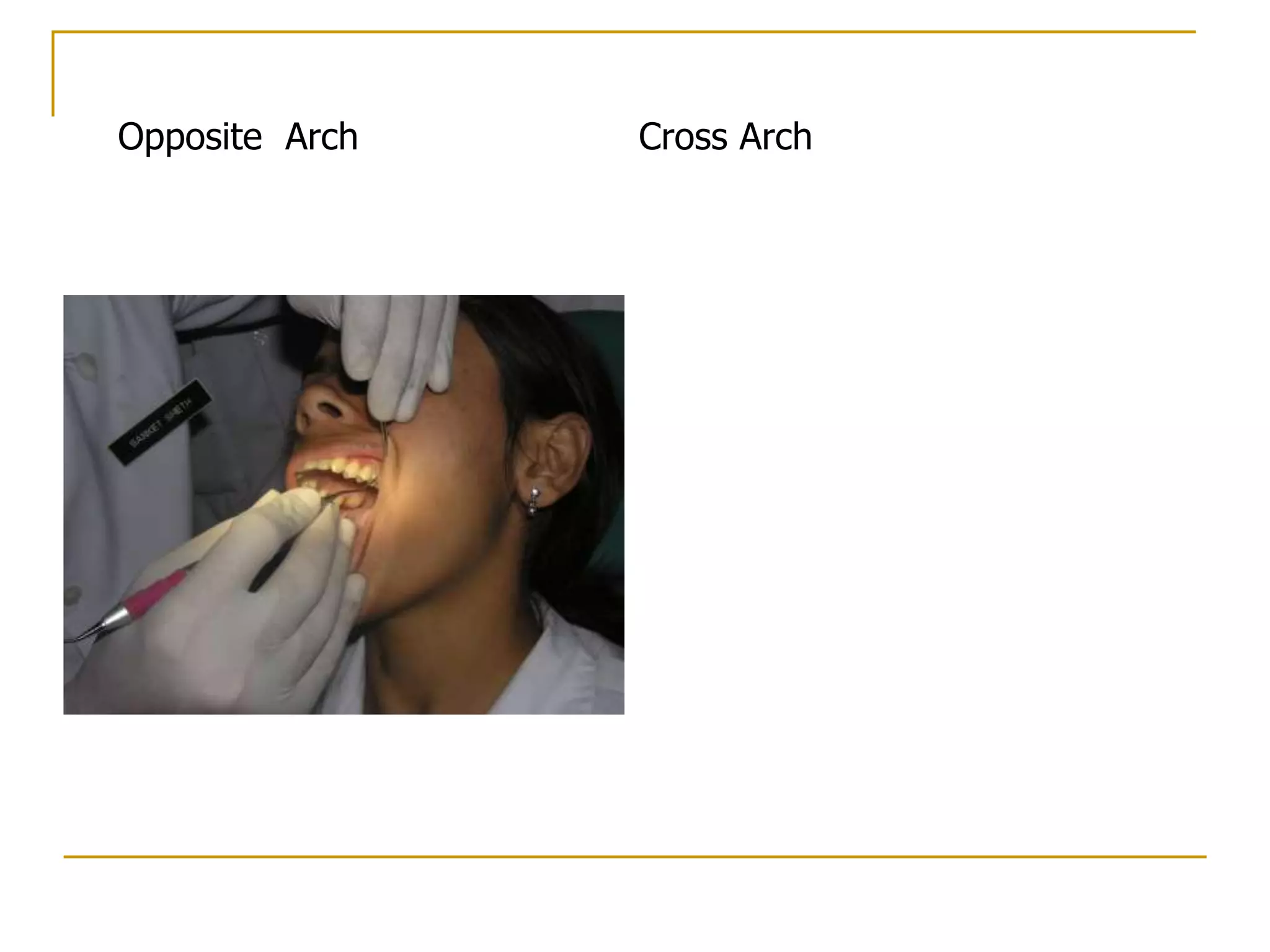 Principles of periodontal instrumentation | PPT