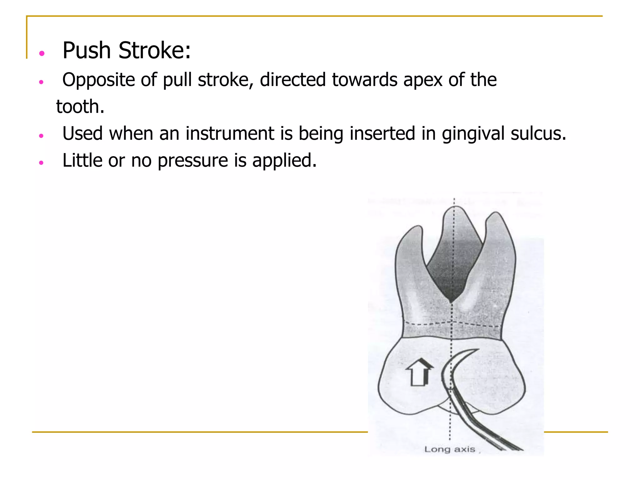Principles of periodontal instrumentation | PPT
