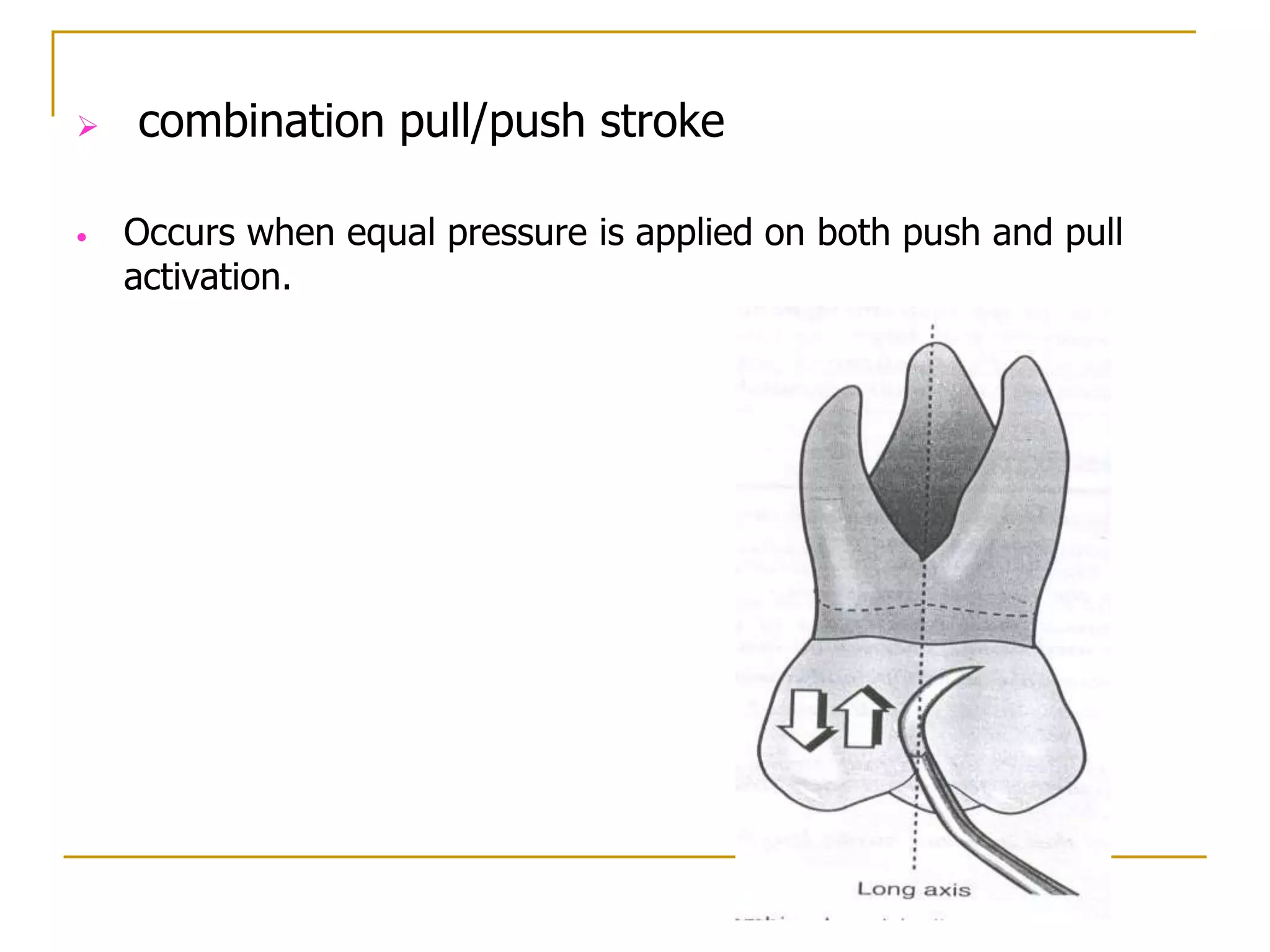 Principles of periodontal instrumentation | PPT