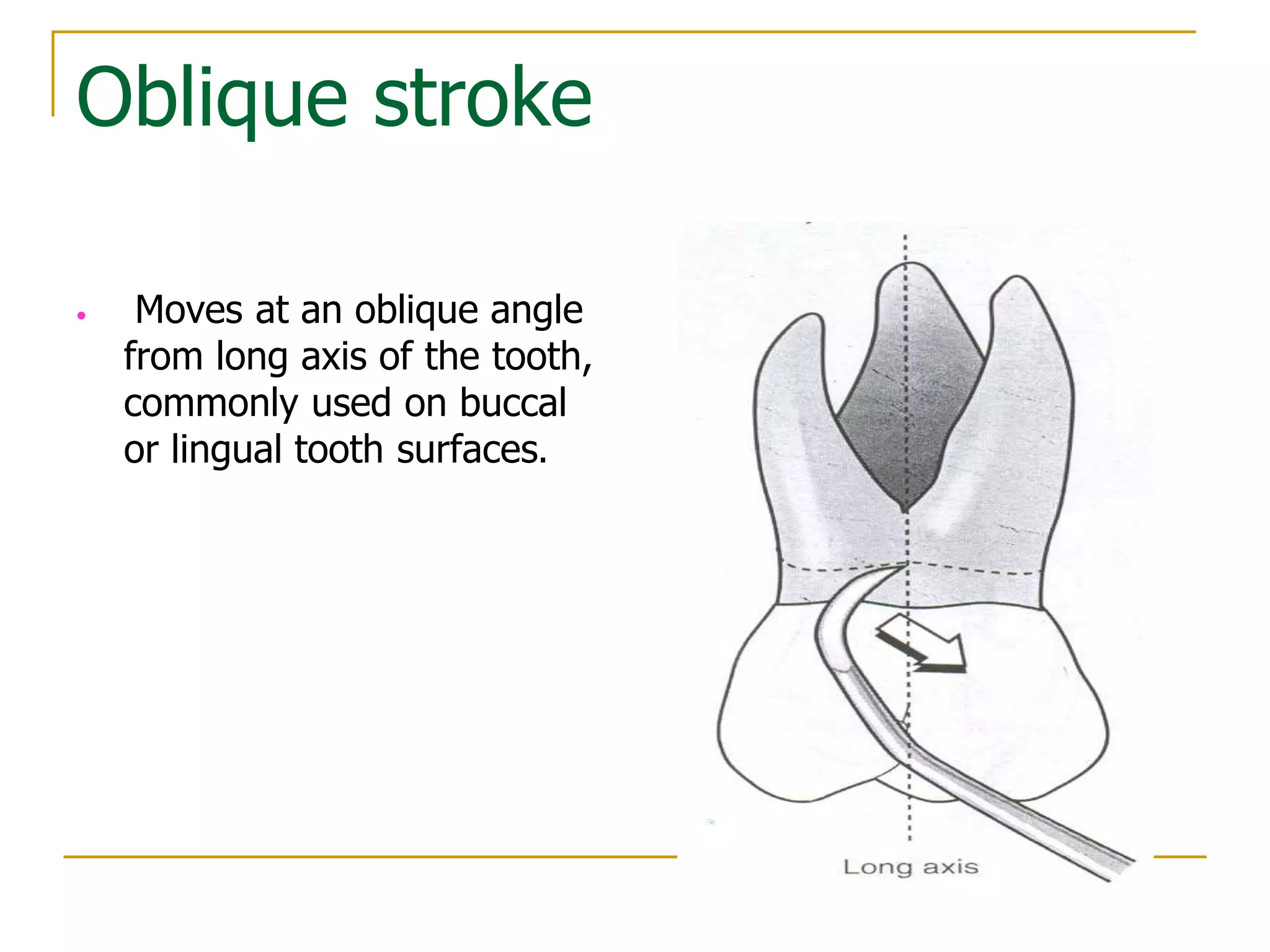 Principles of periodontal instrumentation | PPT