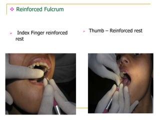 Principles of periodontal instrumentation | PPT