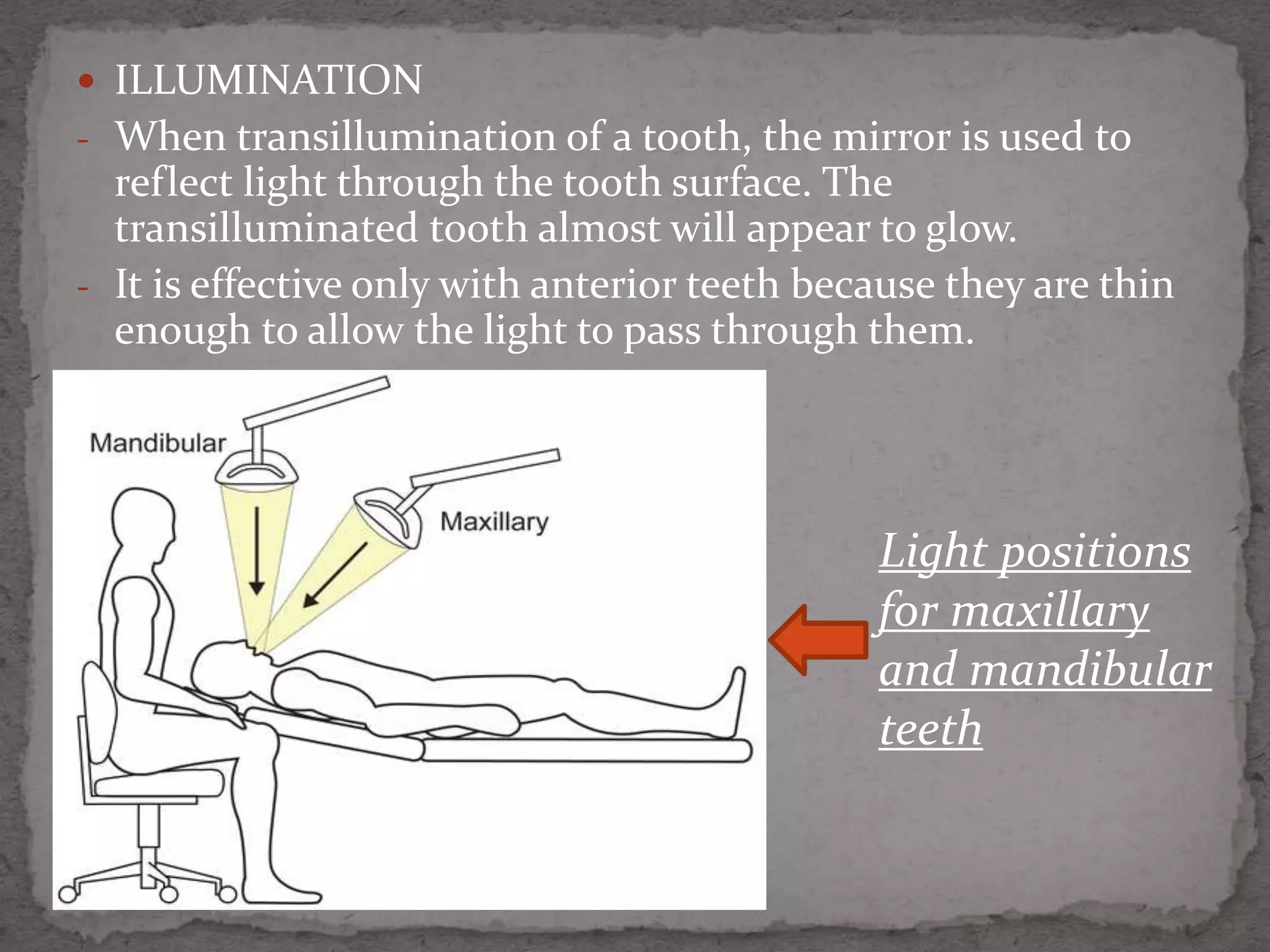 Principles of periodontal instrumentation [autosaved] | PPTX