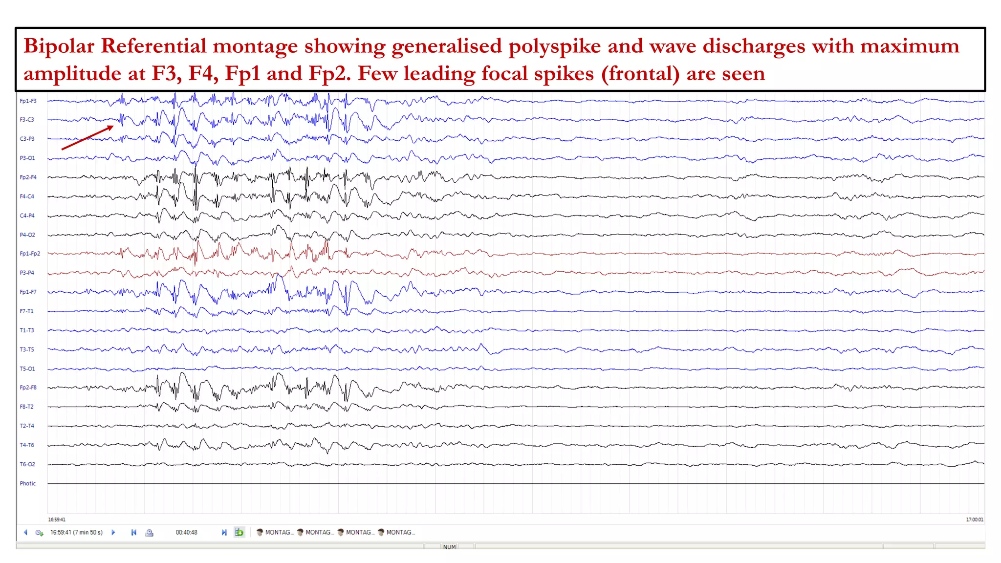 Principles of polarity in eeg | PPTX