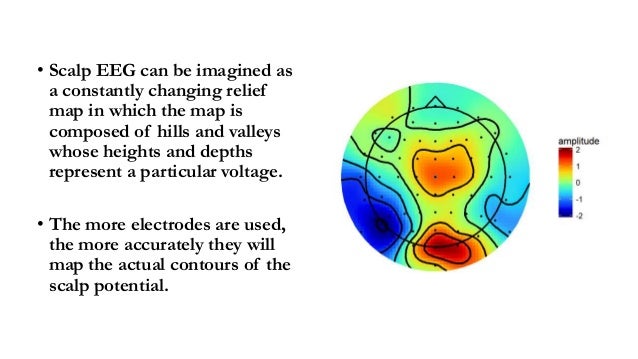 Principles Of Polarity In Eeg principles-of-polarity-in-eeg