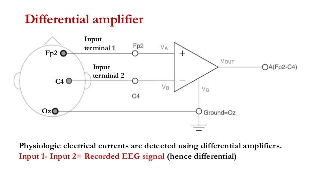 Principles of polarity in eeg