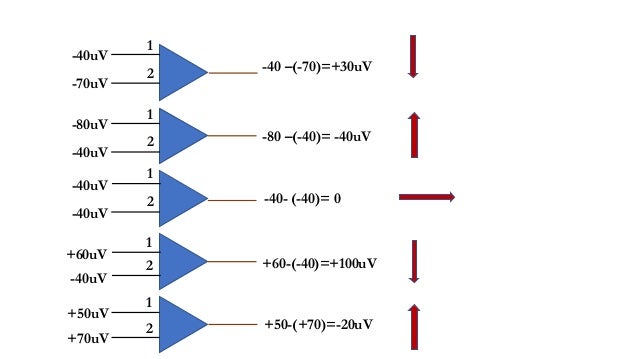 Principles of polarity in eeg
