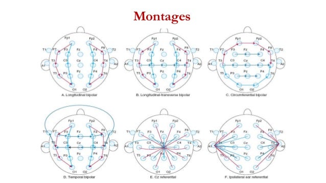 Principles of polarity in eeg