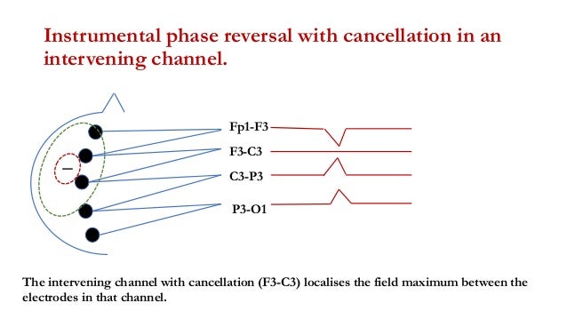 Principles of polarity in eeg